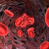 Iron deficiency anaemia | Nursing Times
