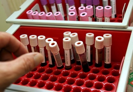 Blood tests and age-related changes in older people | Nursing Times