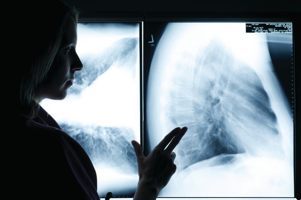 Respiratory nurse named ‘rising star’ by specialist group | Nursing Times