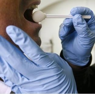 New mouth swab HIV test delivers results in 20 minutes | Nursing Times