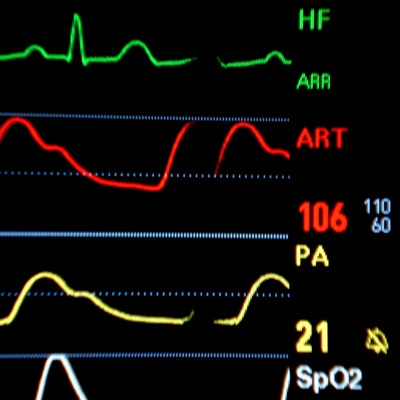 Automatic observation equipment can detract from nursing skills ...