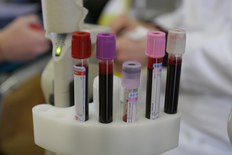 Early identification and treatment of sepsis | Nursing Times