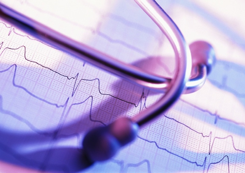 Atrial fibrilation 2: treating and managing atrial fibrillation ...