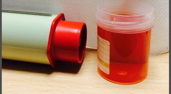 'Beeturia' | Nursing Times