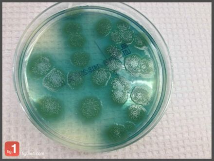 'Pseudomonas' | Nursing Times