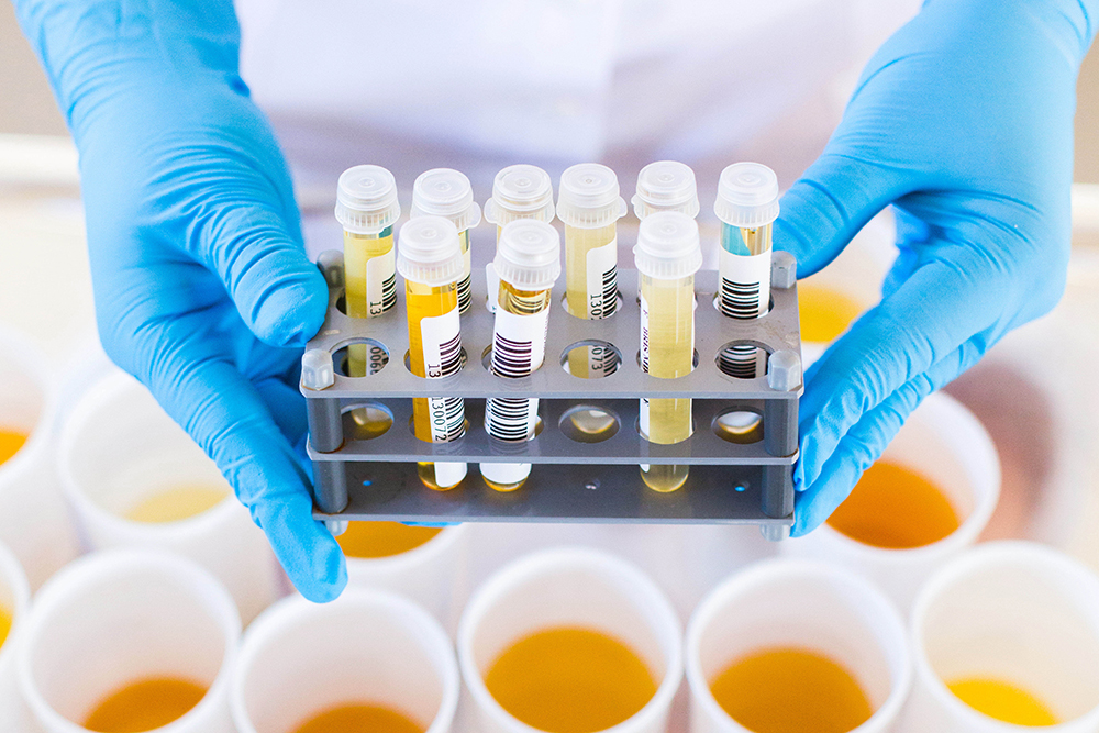 Diagnosing urinary tract infections in children: research-based rules ...