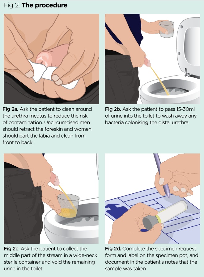 Specimen Collection 1 General Principles And Procedure For Obtaining A 