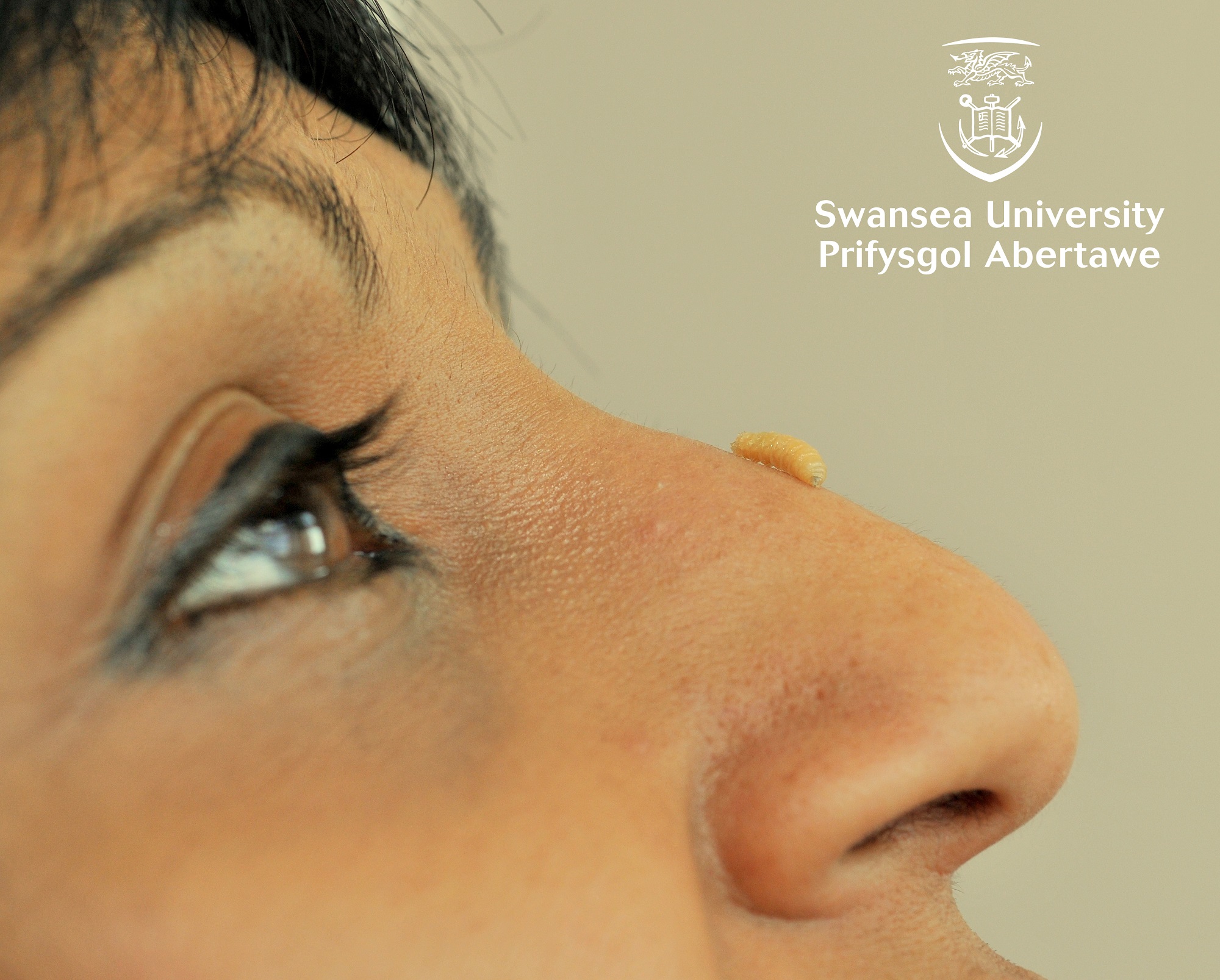 Exclusive: Nurses asked for views on use of maggots in wound care