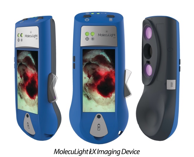 New handheld device 'to improve fundamental wound care' | Nursing Times
