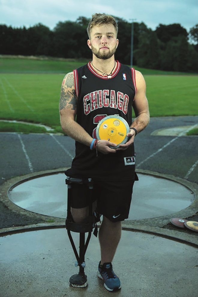 Improving the experience of young men with continence problems ...