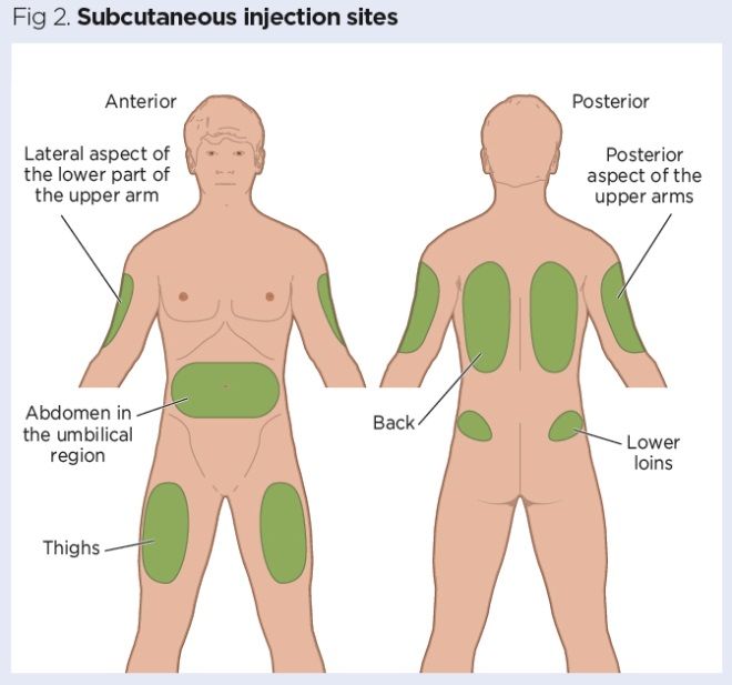 Subcutaneous Injection Technique For Nurses