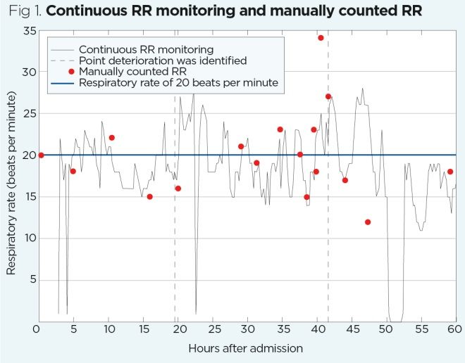 Respiratory rate: the benefits of continuous monitoring | Nursing Times