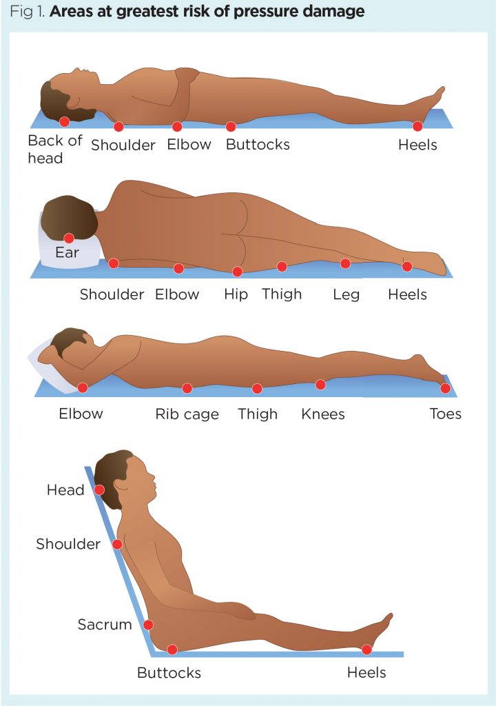 Pressure Ulcer Education 5 Keeping Patients Moving Nursing Times