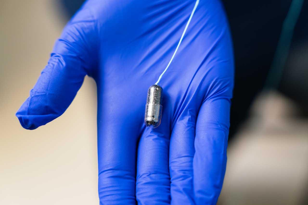 Nurses pioneer use of new ‘sponge’ alternative to endoscopy | Nursing Times