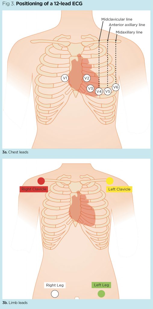 Electrocardiogram 1: purpose, physiology and practicalities | Nursing Times