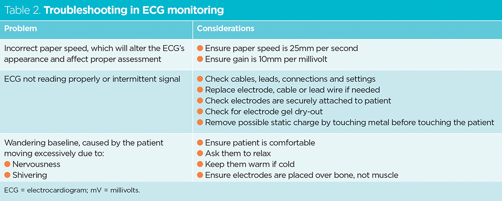 Electrocardiogram 1: purpose, physiology and practicalities | Nursing Times