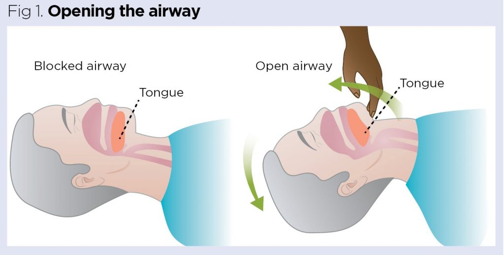 Out-of-hospital resuscitation 1: adult basic life support | Nursing Times
