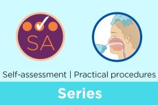 Nasogastric tube insertion 2: placement in adult patients | Nursing Times