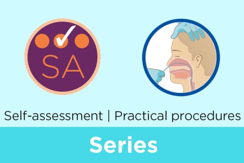 Nasogastric tube insertion 2: placement in adult patients | Nursing Times