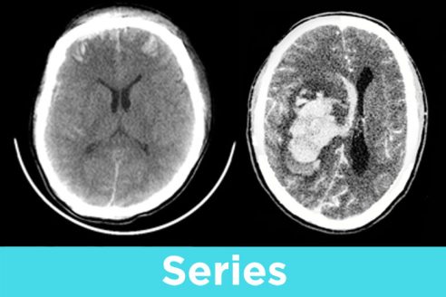 Trauma nursing 3: assessing and managing head injury | Nursing Times