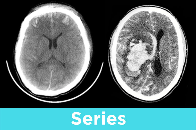 Trauma nursing 3: assessing and managing head injury | Nursing Times