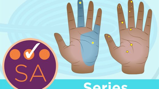 The senses 4: touch – physiology of the sensation and perception of ...