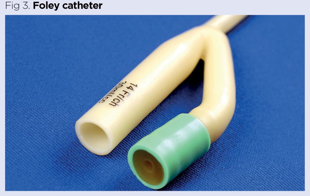 Indwelling urinary catheter insertion 1: children and young people ...