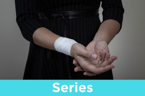 Trauma nursing 5: identifying and assessing patients who self-harm ...