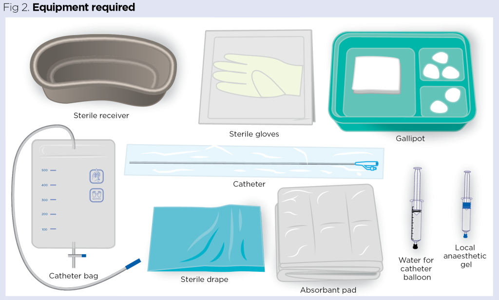 Indwelling urinary catheter insertion 2: procedure for adults | Nursing ...