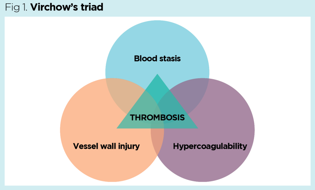 Pulmonary embolism: diagnosis, risk factors and preventive management ...