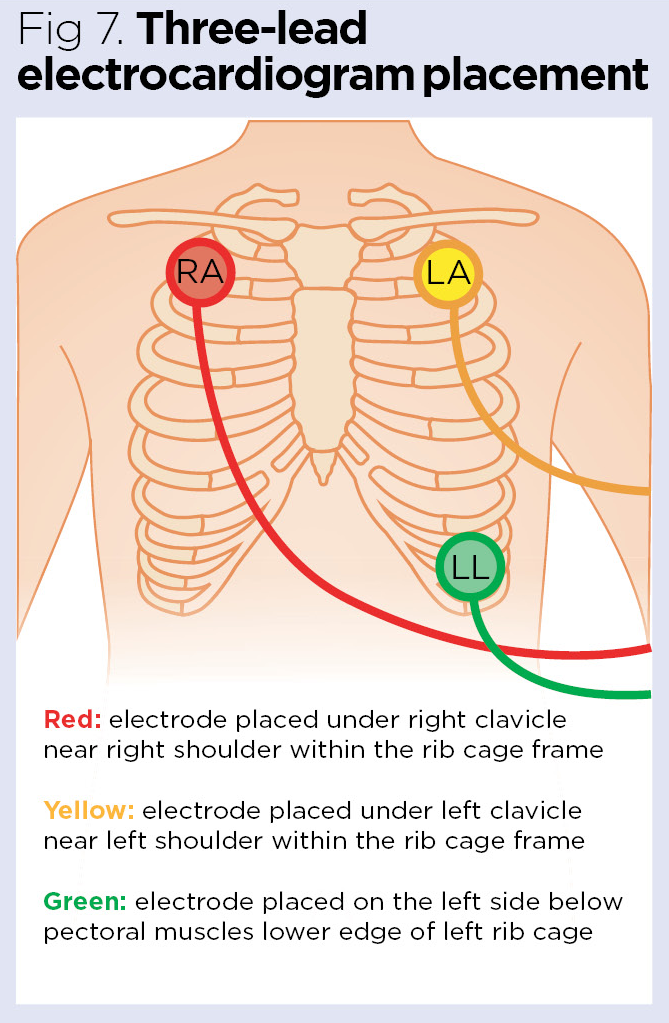 Adult emergency trolley 2: equipment to support circulation | Nursing Times