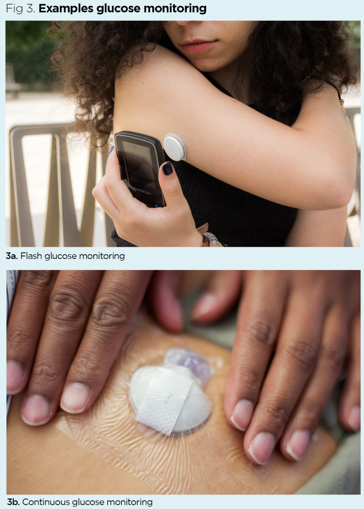 Type 1 diabetes: treatment, management and the use of insulin | Nursing ...