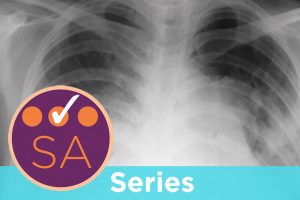 How to interpret chest radiographs (X-rays): a systematic approach ...