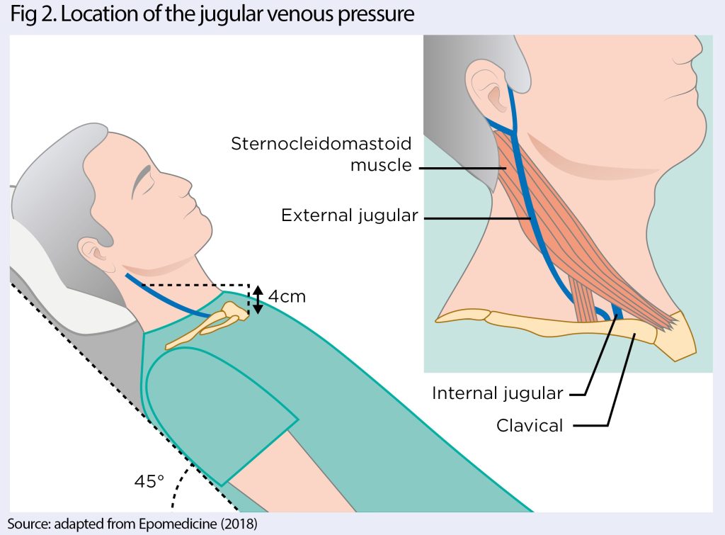 How to conduct a cardiovascular assessment in advanced practice ...