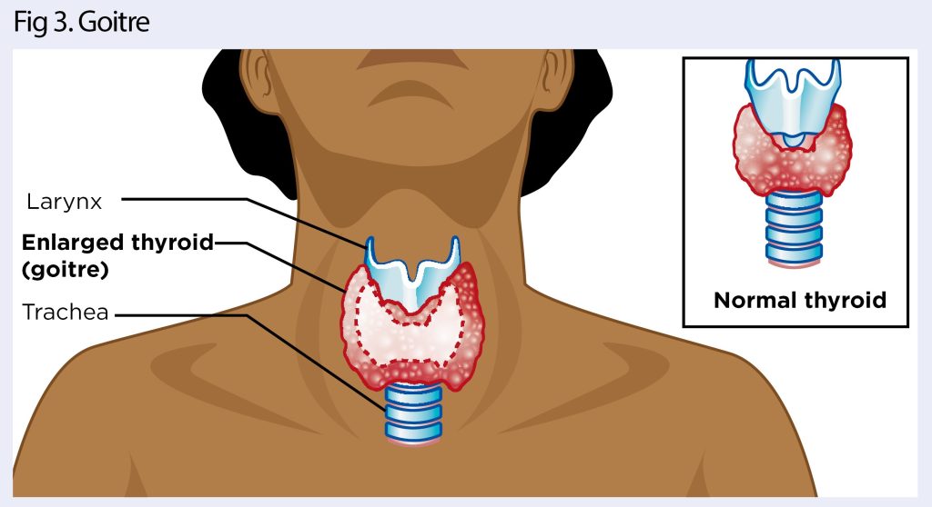 Magnesium and microminerals: roles, deficiency and excess | Nursing Times