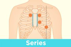 How to conduct a cardiovascular assessment in advanced practice ...