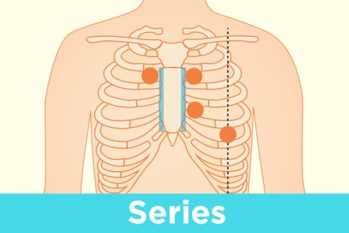 How to conduct a cardiovascular assessment in advanced practice ...