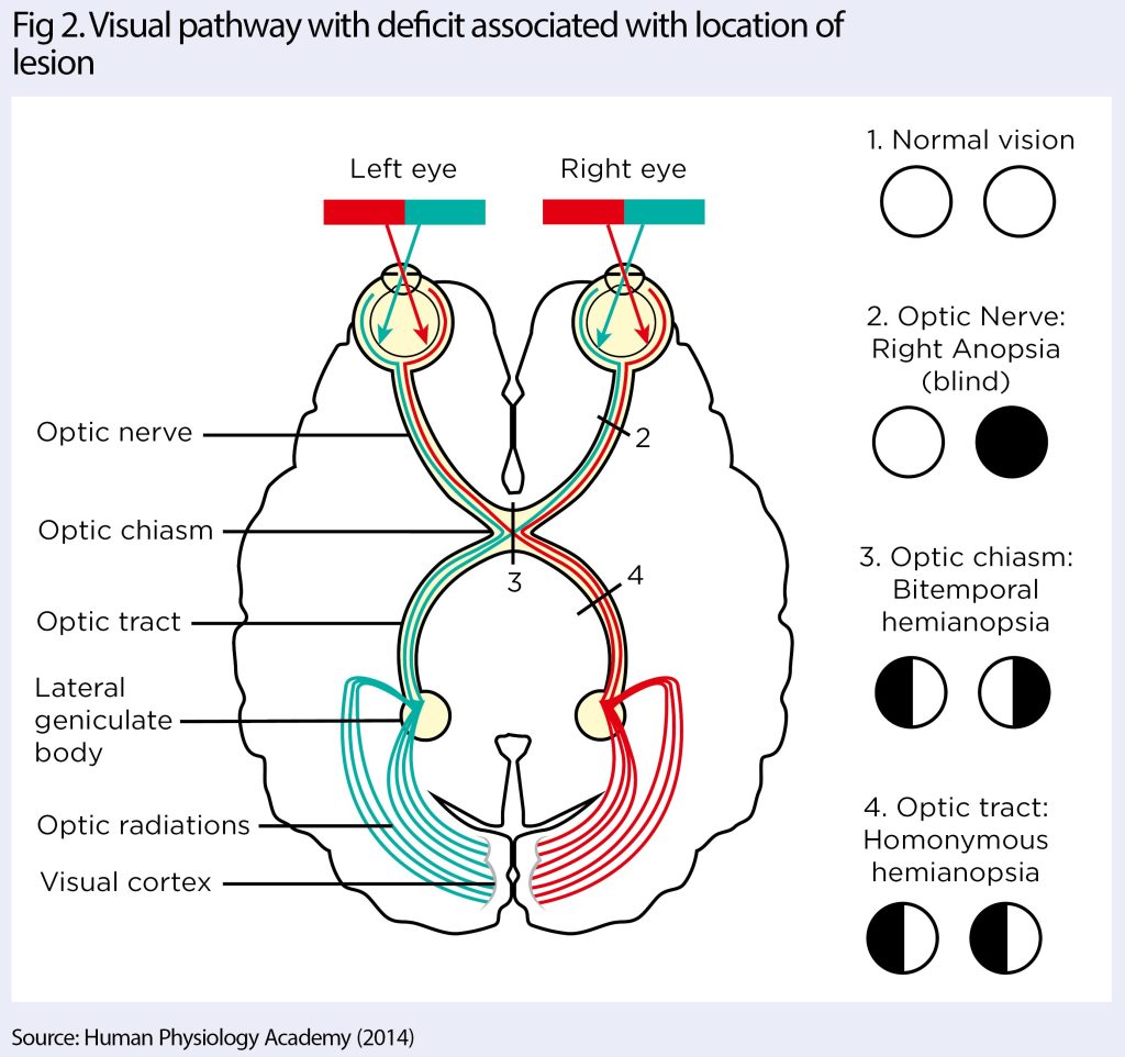 Performing a cranial nerve examination and interpreting the findings ...