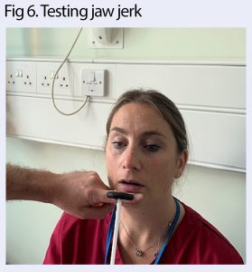 Performing a cranial nerve examination and interpreting the findings ...