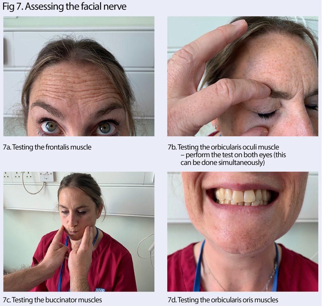 Performing a cranial nerve examination and interpreting the findings ...