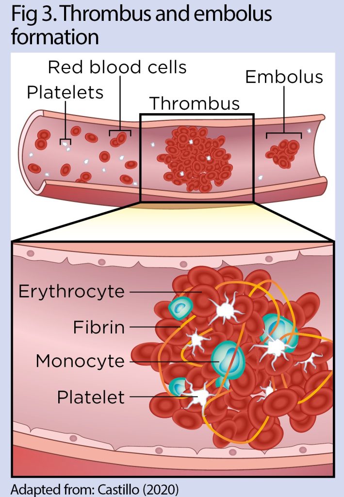What Causes Abnormal Blood Clotting