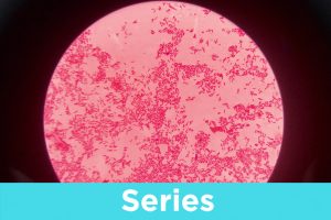 Understanding microbiology tests and interpreting the results | Nursing ...