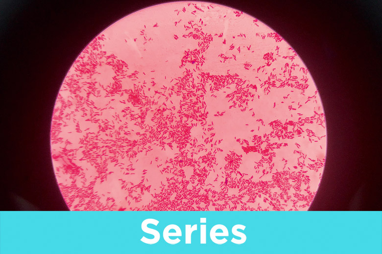 Understanding microbiology tests and interpreting the results | Nursing ...