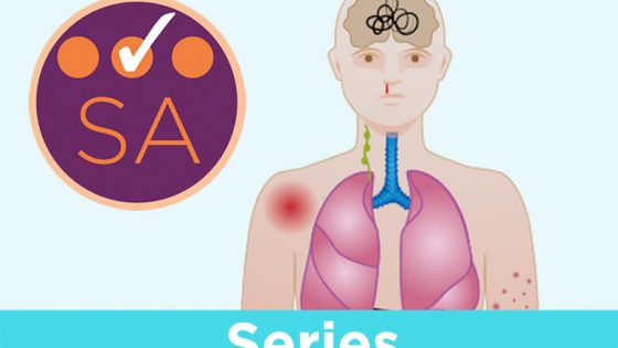 Understanding leukaemia: risk factors, symptoms and treatment | Nursing ...