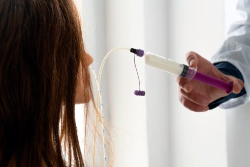 Nasogastric tube feeding children and young people with restraint ...