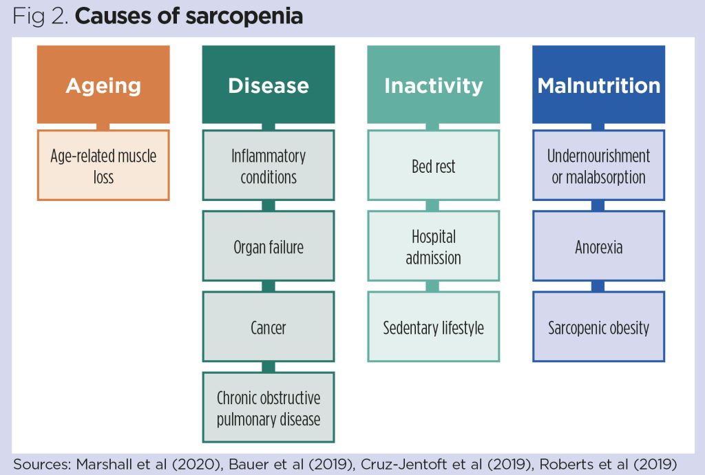 Sarcopenia: types, causes, diagnosis and impact | Nursing Times