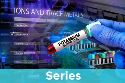 How to interpret electrolyte blood results to identify abnormalities ...