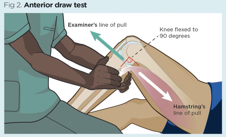 Assessment and management of knee pain: taking a holistic approach ...