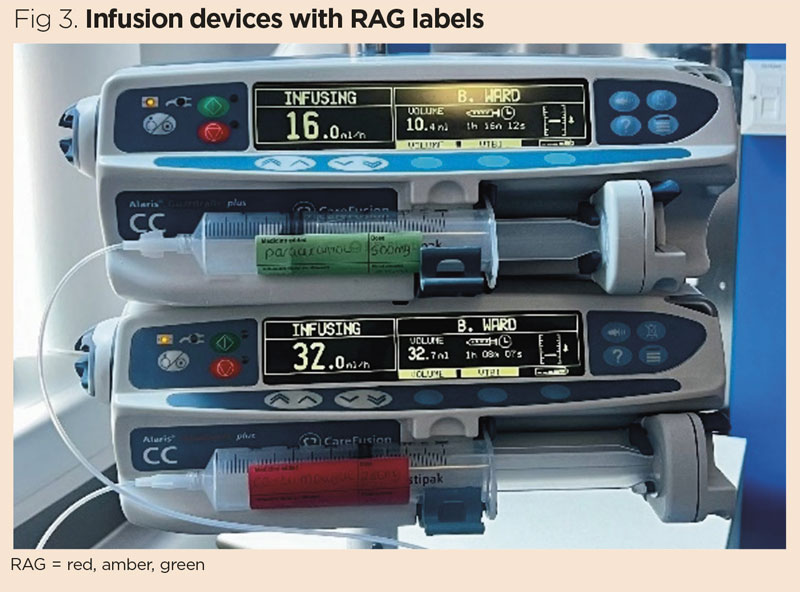 Reducing harm of extravasations in IV medicine administration | Nursing ...
