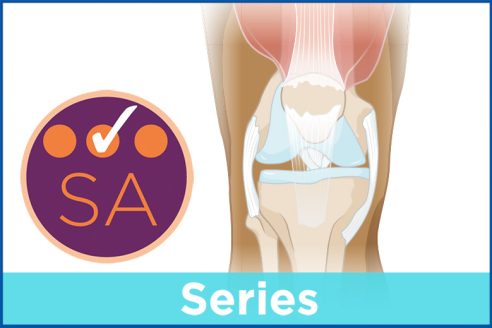 Assessment and management of knee pain: taking a holistic approach ...